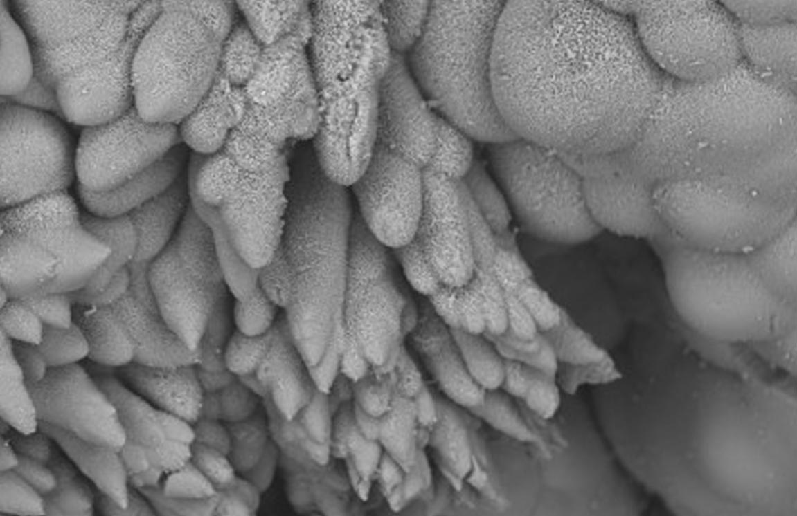 Investigation of cold water pitting corrosion failure - Elkeme